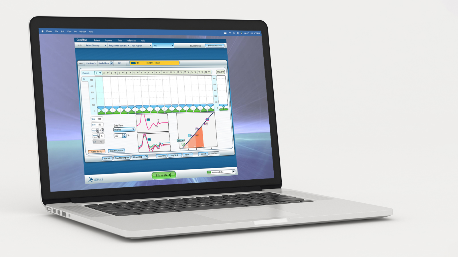 SOUNDWAVE 1.5 – Pulse Design Group – Product Design